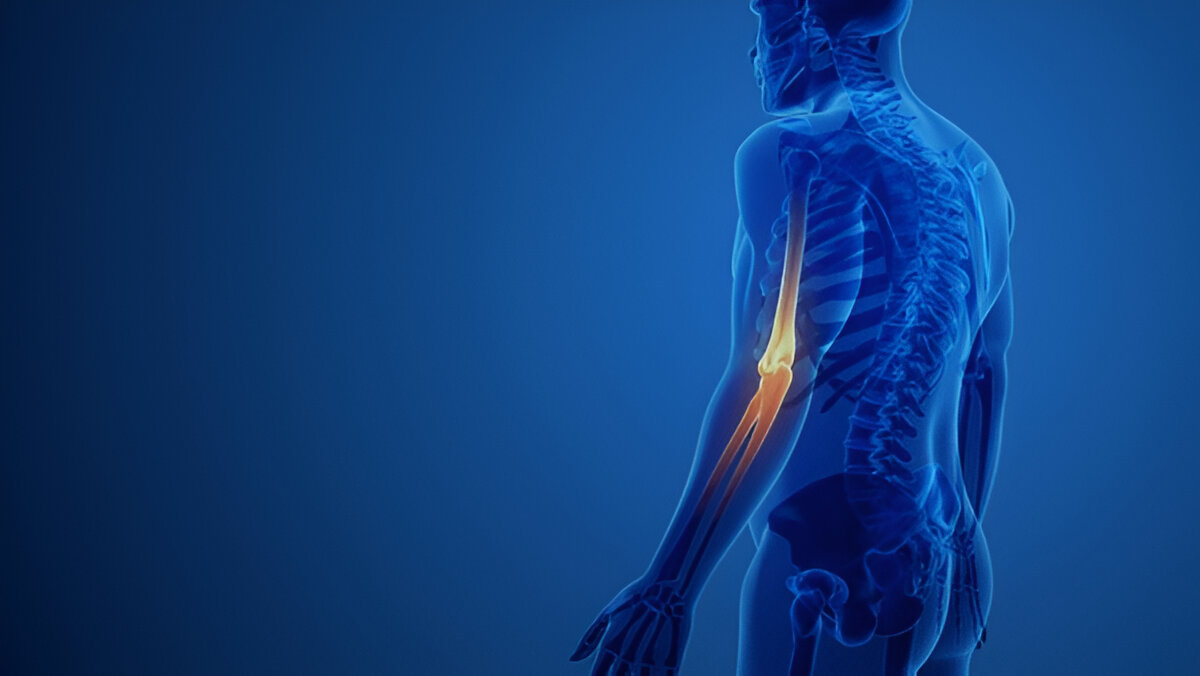 Recurrent Elbow Instability - kerlan jobe