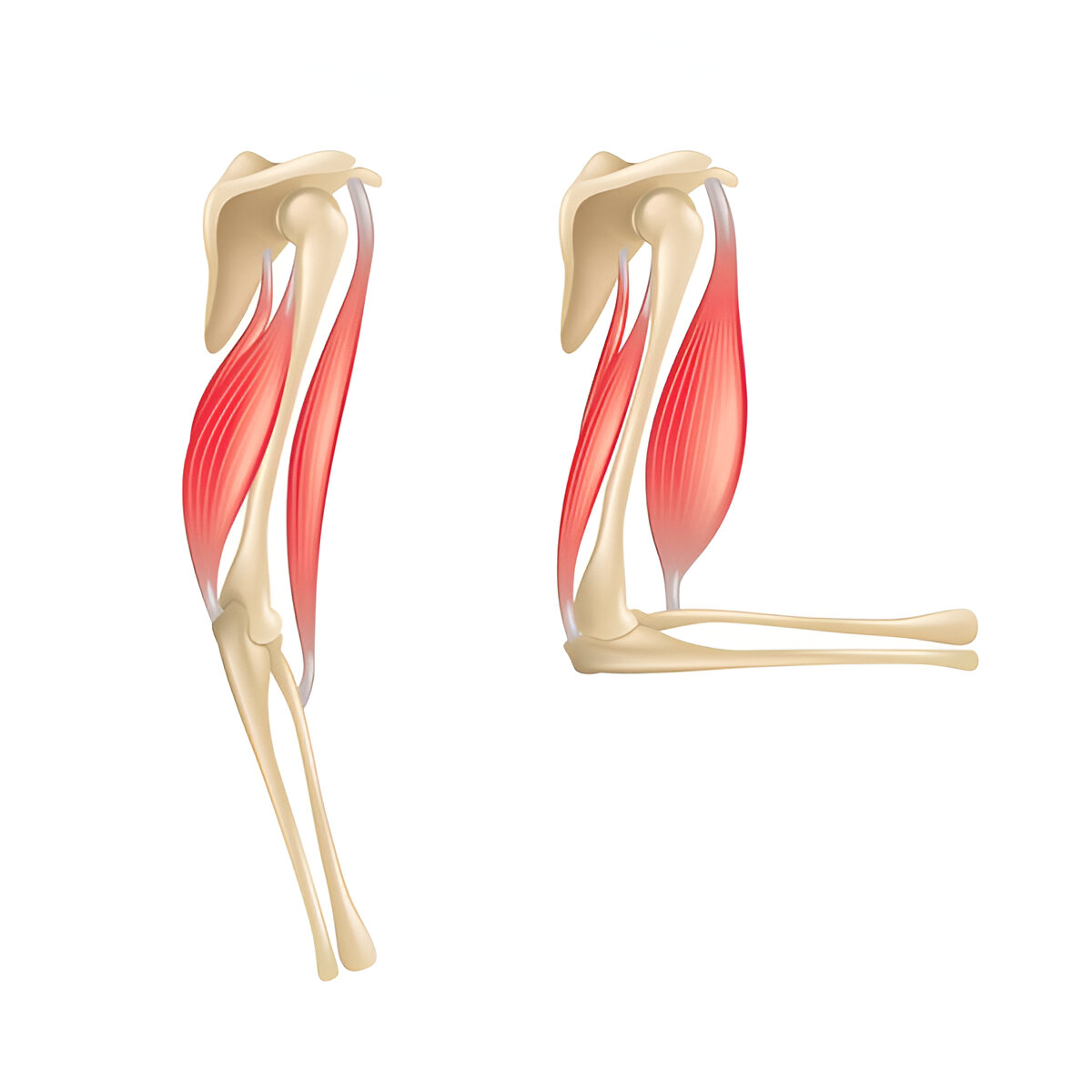 Triceps Tendon Injury - kerlan jobe