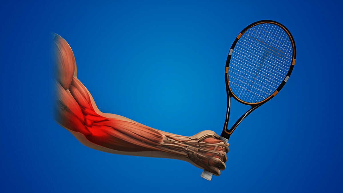 Valgus Extension Overload Syndrome - kerlan jobe